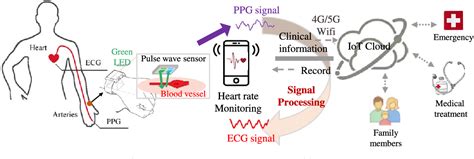 Figure 1 From Photoplethysmography Based Heart Action Monitoring Using A Growing Multilayer