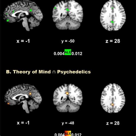 Overlap Of Brain Activation Between Social Cognition Theory Of Mind