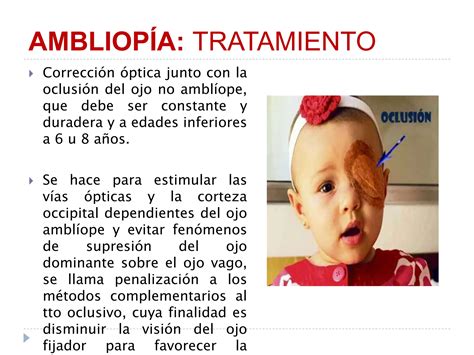 Estrabismo Y Neuro Clasas De Oftalmologia Ppt