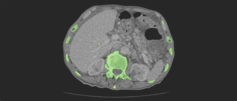 Role Of Medical Image Annotation In AI Medical Image Diagnostics