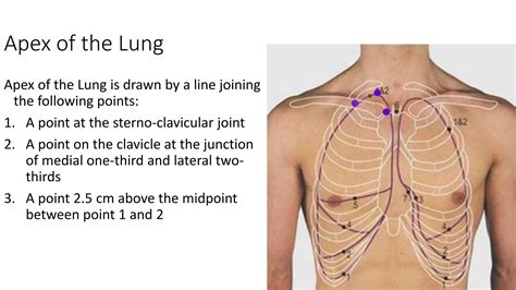 Surface Marking Thorax Pptx