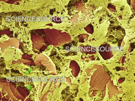 Sputum Scanning Electron Micrograph Stock Image Science Source Images