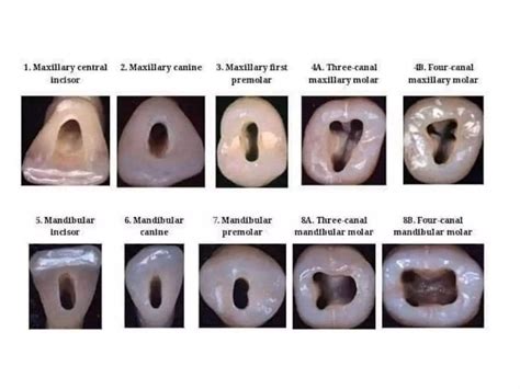 Morphology And Internal Anatomy Of Root Canal System Pptx