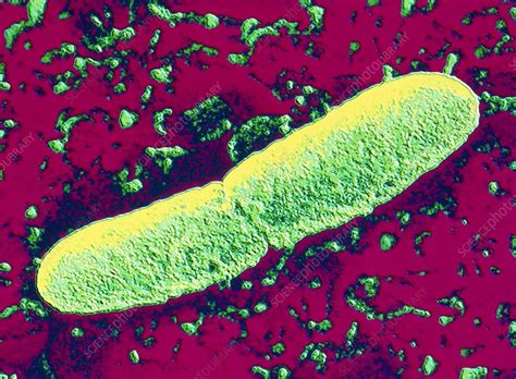 Bubonic Plague Bacteria