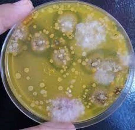 Powder Phosphate Solubilizing Bacteria Packaging Type Bag 5 Litre At