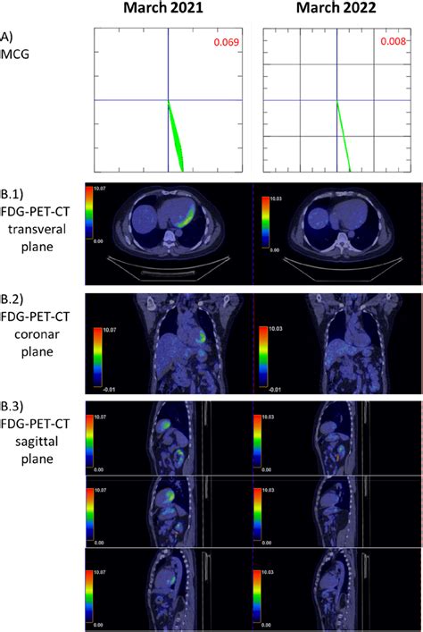 Comparison Of Fluorodeoxyglucose Positron Emission Tomography Computed Download Scientific