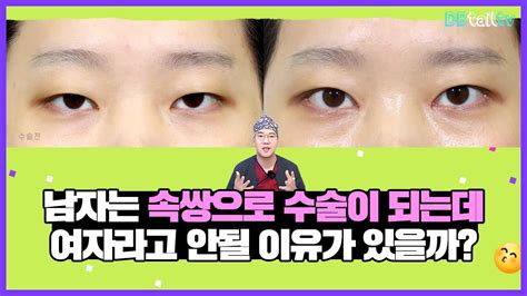 남자는 속쌍으로 수술이 되는데 여자라고 안될 이유가 있을까 Youtube