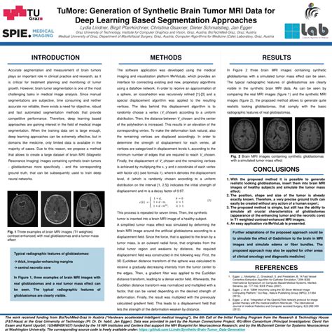 Pdf Tumore Generation Of Synthetic Brain Tumor Mri Data For Deep