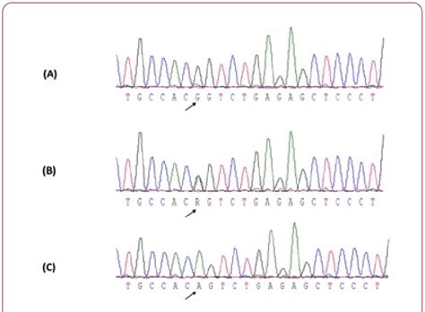 The Chromatogram Of Sanger Sequenced Data Showing A The Wild Type