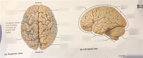 Transverse And Longitudinal Fissure