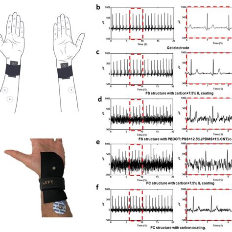 Agarelectrode Impedance Of Dry Textile Electrodes Fs Structure At The Download Scientific