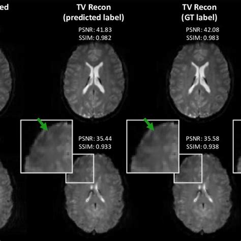 Proposed Network Architecture Input Y Of The Network Is The Motion Download Scientific Diagram