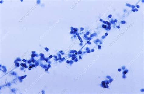 Coccidioidomycosis Fungus Micrograph Stock Image C0222777