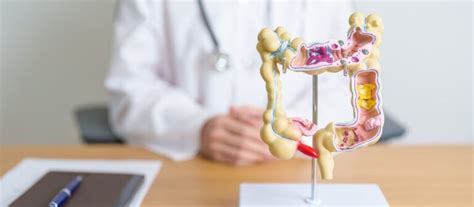 Imágenes En Colitis Ulcerosa Visualizando Las Alteraciones En El Colon
