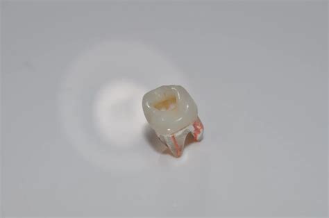 Root Pulp Cavity Teeth Model For Endodontic Training