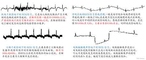 基于stm32f4的心电监护仪 ads1292r csdn博客