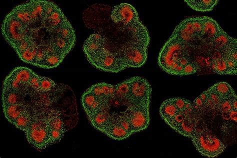 Making Lab Grown Brain Organoids ‘brainier Ucla