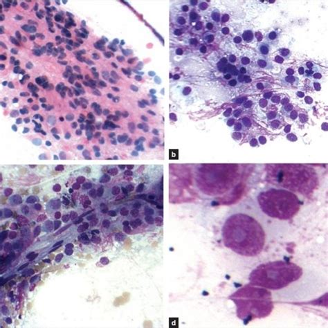 A D Photomicrograph Of Cytology Smears Showing A Hypercellular Smear Download Scientific