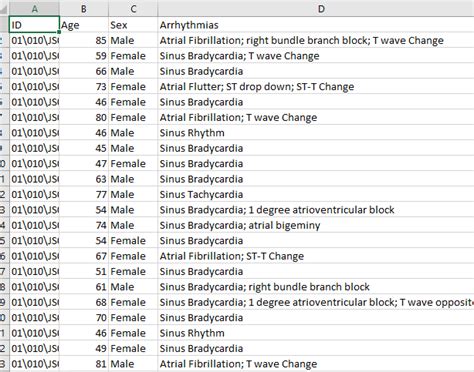Decoding Cardiac Signals Exploring Data Science For Arrhythmia Detection Using Ecg Dataset By