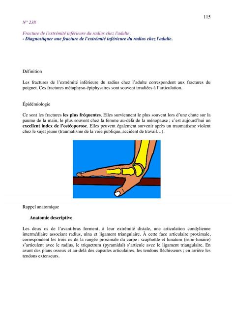 N° 238 Fracture Du Radius
