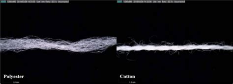 Two Kinds Of Yarn Under The Microscope Download Scientific Diagram