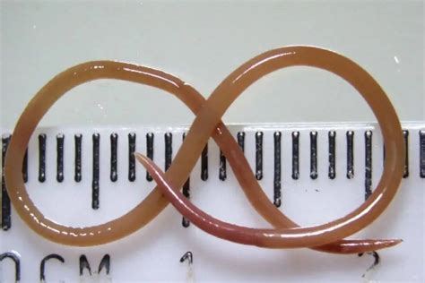 Live Worm Found In Australian Womans Brain Zoonotic Diseases Live Worm Found In Australian Womans Brain Zoonotic Diseases