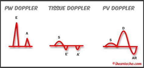 The Echocardiographer S Role In Lv Diastology Assessment