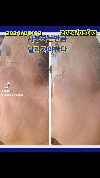 달라져야한다 달라진다 남다르대중성 바르는순간 변화하기시작 케이셀채움 슬림케이셀 슬림앤슬림 Newbaba Youtube