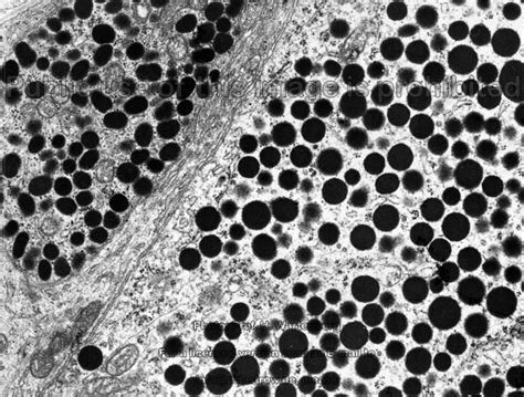 Secretory Vesicles Drjastrow39s Electron Microscopic Atlas