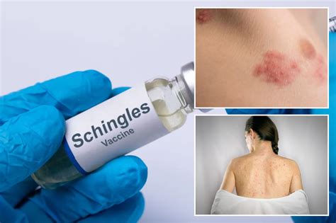 Popular Thyroid Medication Levothyroxine Linked To Bone Loss