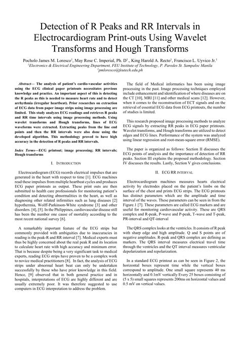 pdf detection of r peaks and rr intervals in electrocardiogram print