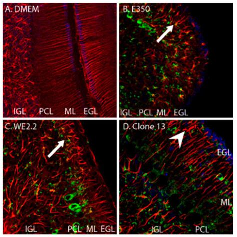 viruses special issue lcmv a pillar for immunology research