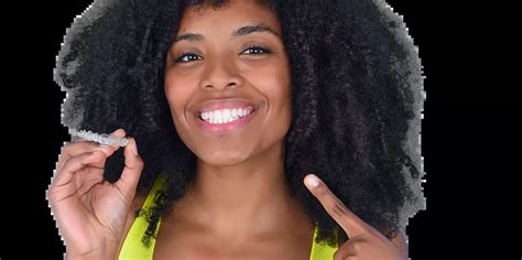 Docbraces Metal Braces Affordable Orthodontic Solutions For All