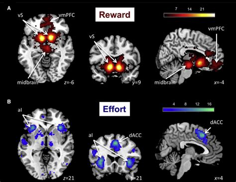 Meta Analysis Of Reward And Effort Neural Representations Involved In Download Scientific