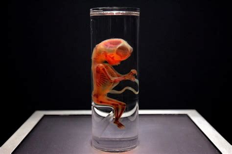 Lab Grown Human Embryo Models Spark Calls For Regulation Abs Cbn