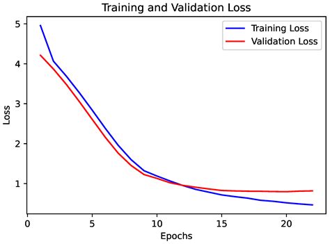Deep Learning Based Glaucoma Detection Using Clinical Notes A Comparative Study Of Long Short