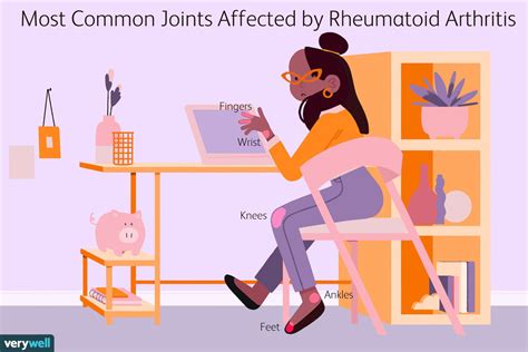 Early Rheumatoid Arthritis Symptoms