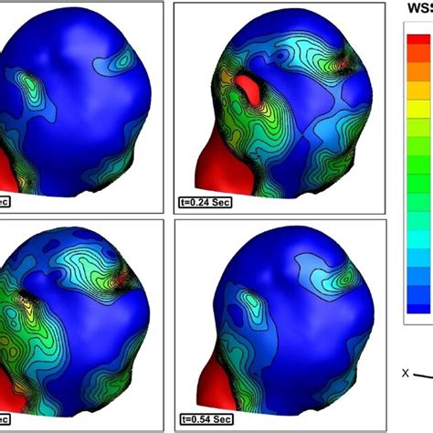 Geometry Of Chosen Mca Aneurysm Download Scientific Diagram