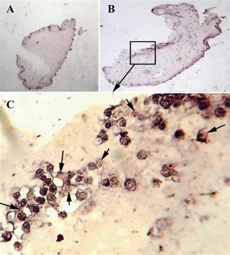 Design And Fabrication Of Anatomical Bioreactor Systems Containing Alginate Scaffolds For