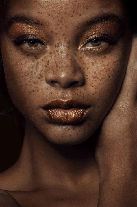 Discover 110 Black Girls With Freckles And Black Freckles Woman Ideas