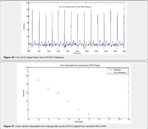 Figure 17 From Removal Of The Power Line Interference From Ecg Signal Using Different Adaptive