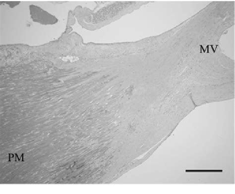 Figure 1 From Mitral Stenosis With Bacterial Myocarditis In A Cat