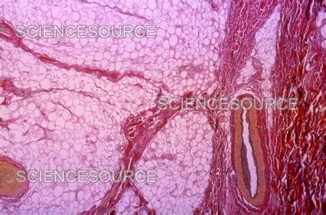 Subcutaneous Tissue From Scalp Lm Stock Image Science Source Images