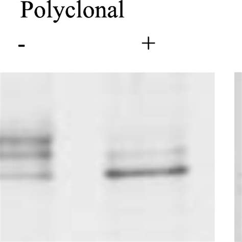 A Effect Of Pma On Gap Junctional Intercellular Communication Gjic Download Scientific