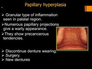 Histology Of Oral Mucous Membrane And Gingiva Pptx