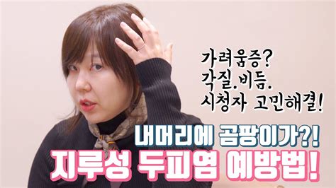 원장님 머리가 너무 간지러워요 지루성두피염 Youtube