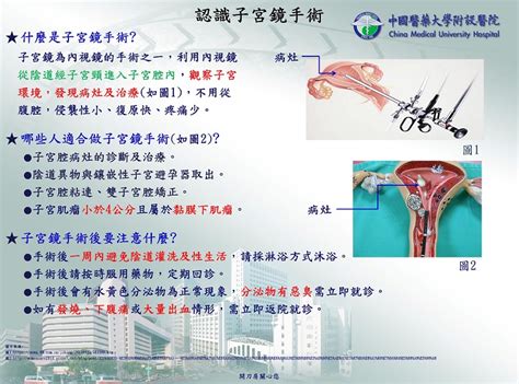 子宮鏡手術術後 子宮内膜ポリープ 手術方法 Kboug