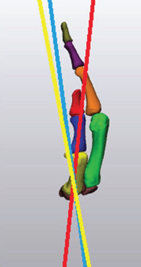 The Rotation Axes Of The 1st Metacarpal When Pinching Cylinders With 2 Download Scientific