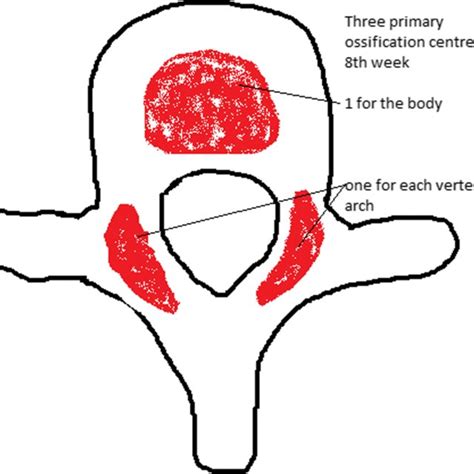 A Maintaining Distraction At The Opened Spinous Processes To Facilitate Download Scientific
