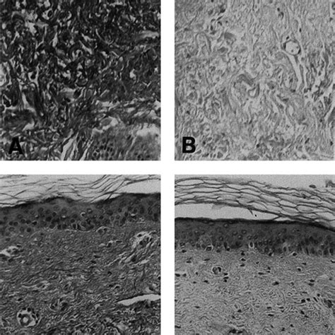 Evaluators Global Acne Severity Scale Download Table